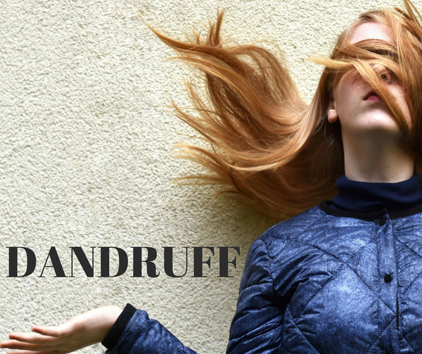 Dandruff – Facts, Causes, Symptoms, Prevention and Treatment - Earth's ...